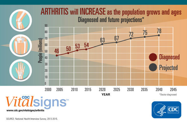 Understanding arthritis | Michigan Today